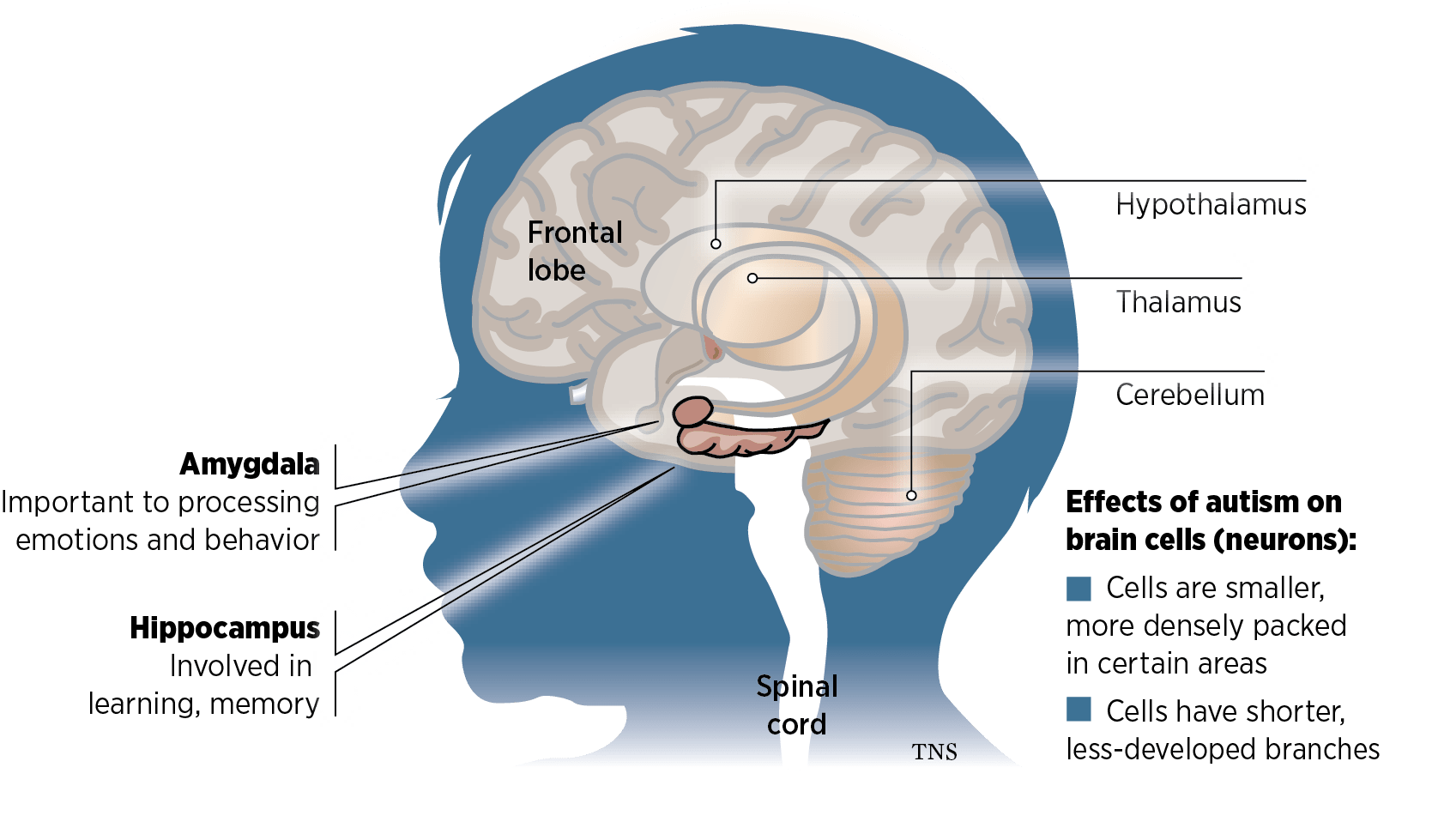 Further Review Autism Spectrum Disorder The Spokesman Review